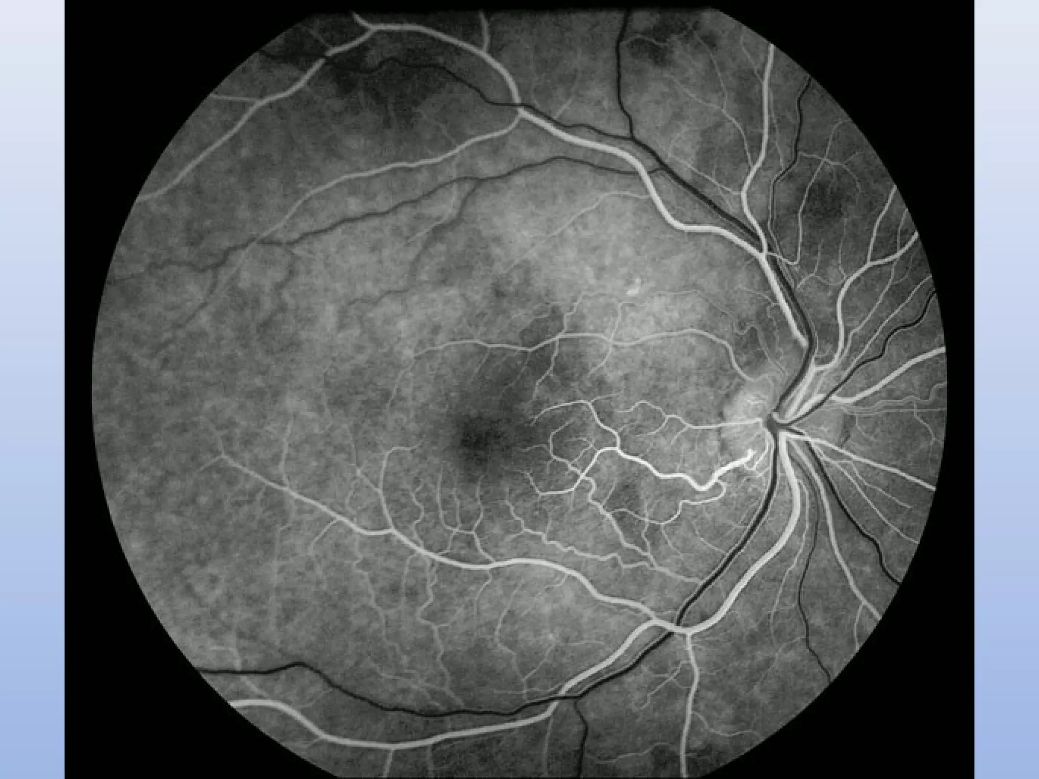 Anatomy of Retina | PPT