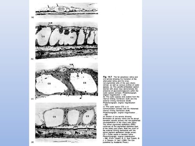 Anatomy of Retina | PPT | Eye and Vision Conditions | Diseases and ...