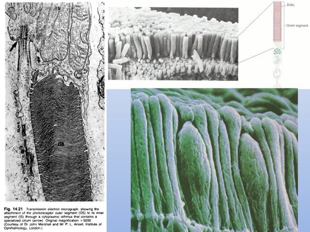 Anatomy of Retina | PPT | Eye and Vision Conditions | Diseases and ...