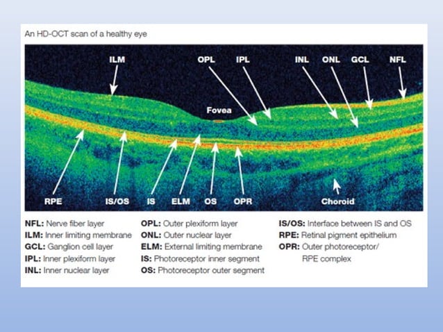 Anatomy of Retina | PPT | Eye and Vision Conditions | Diseases and ...