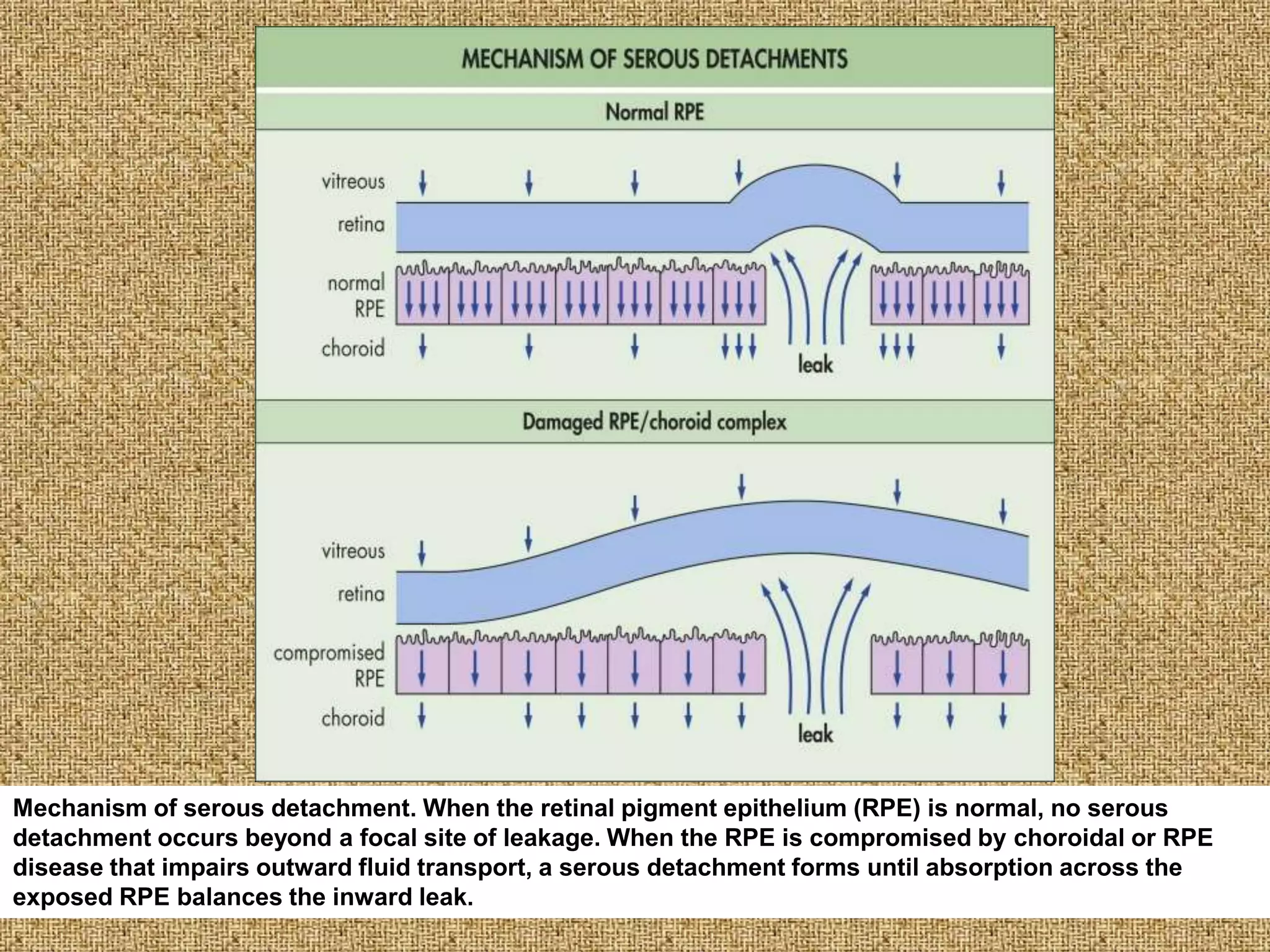 Anatomy of retina | PPTX