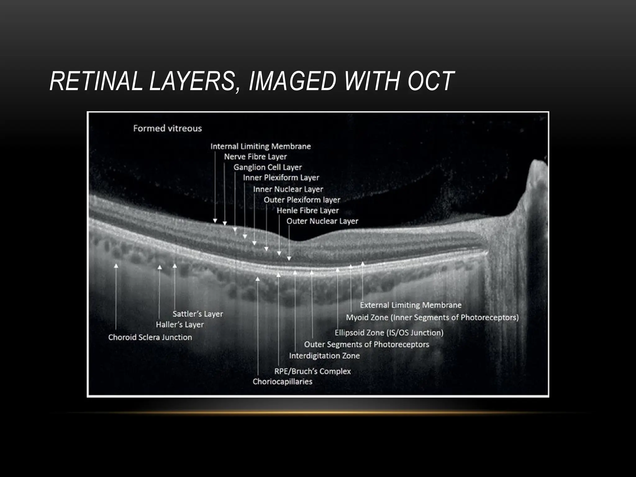 Anatomy of Retina and Visual pathway.pptx