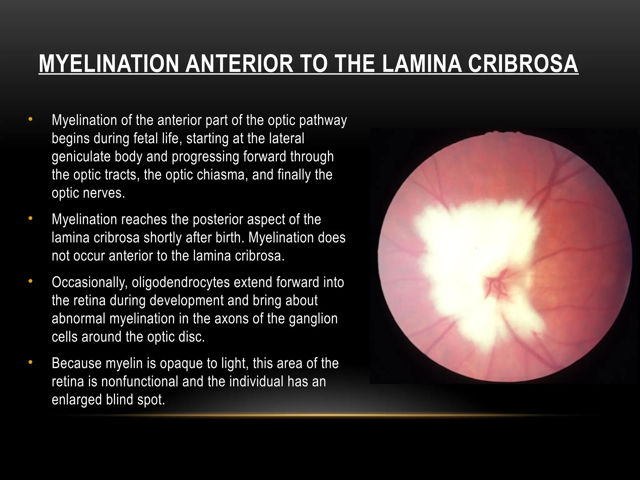 Anatomy of Retina and Visual pathway.pptx