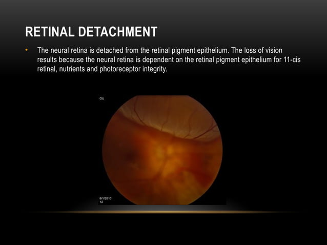 Anatomy of Retina and Visual pathway.pptx