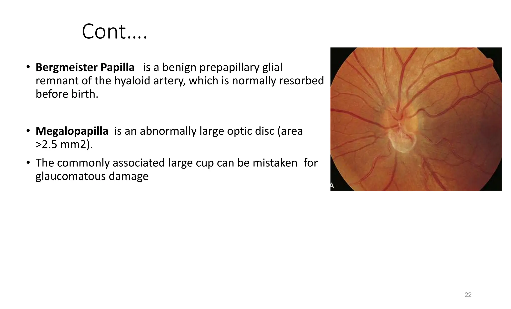 Anatomy of retina power points. I1.ppt