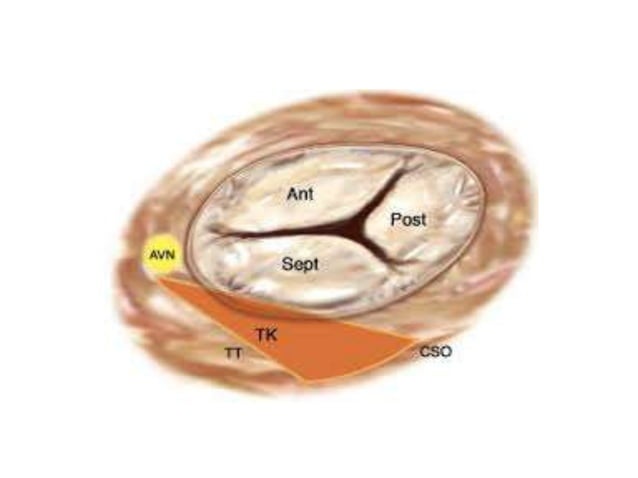 Anatomy of right atrium | PPTX | Heart and Cardiovascular Diseases ...