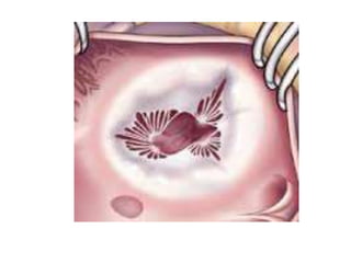 Anatomy of right atrium | PPTX