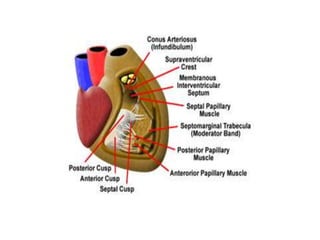 Conus Arteriosus Infundibulum