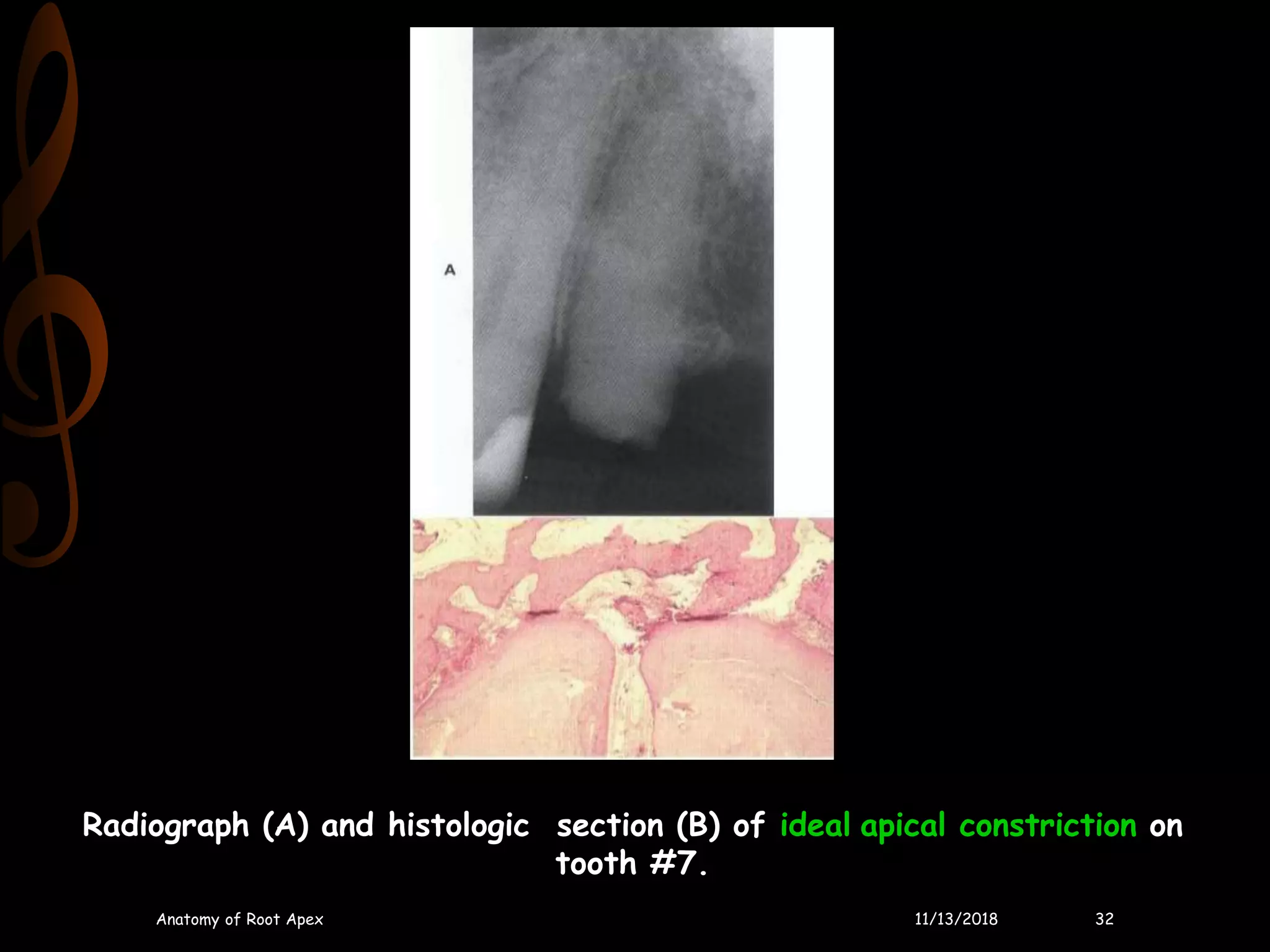 Anatomy of root apex | PPTX