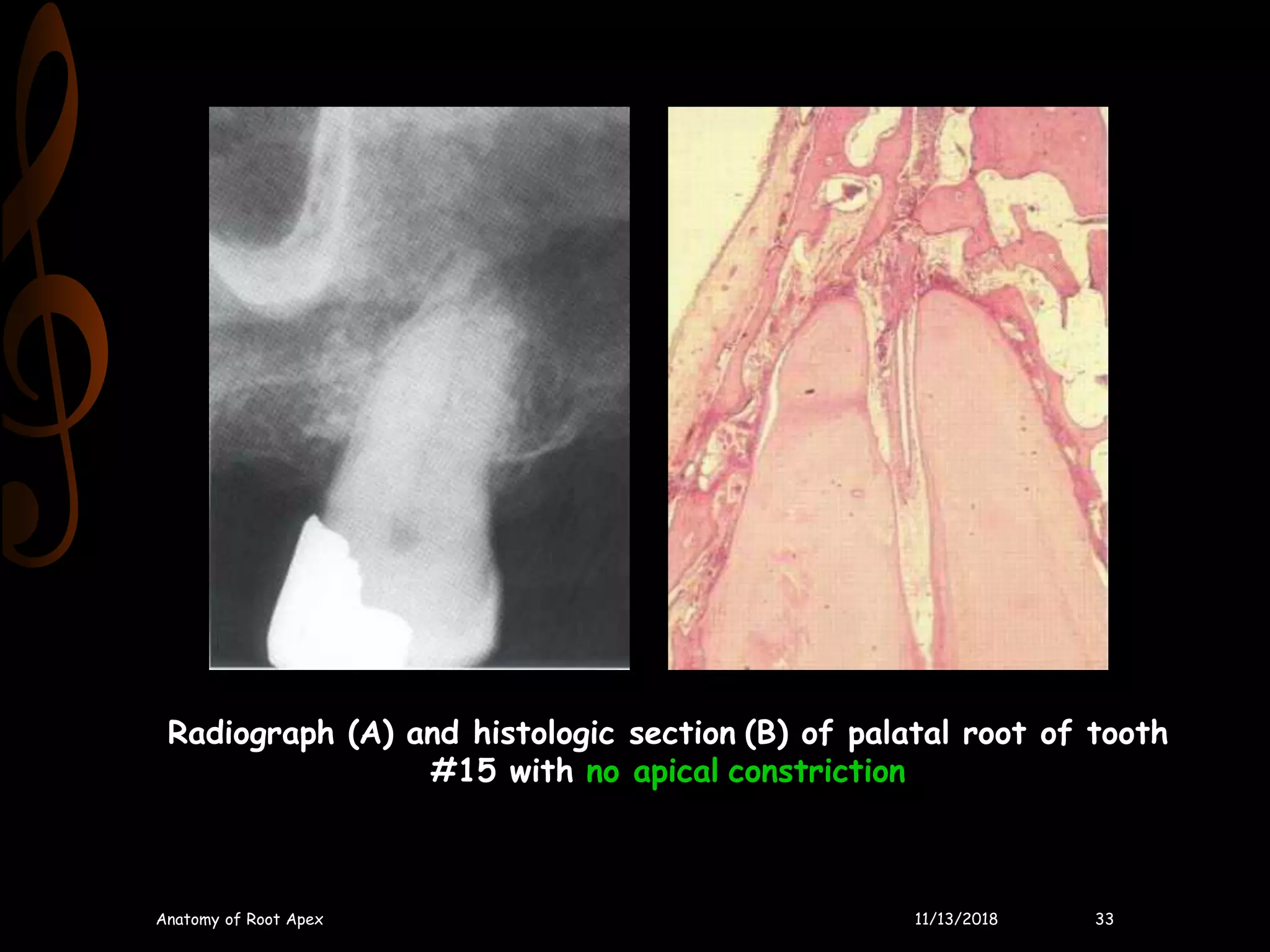 Anatomy of root apex | PPTX