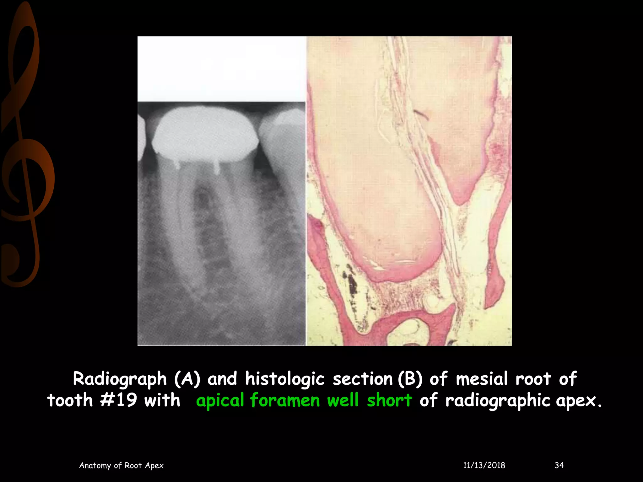 Anatomy of root apex | PPTX