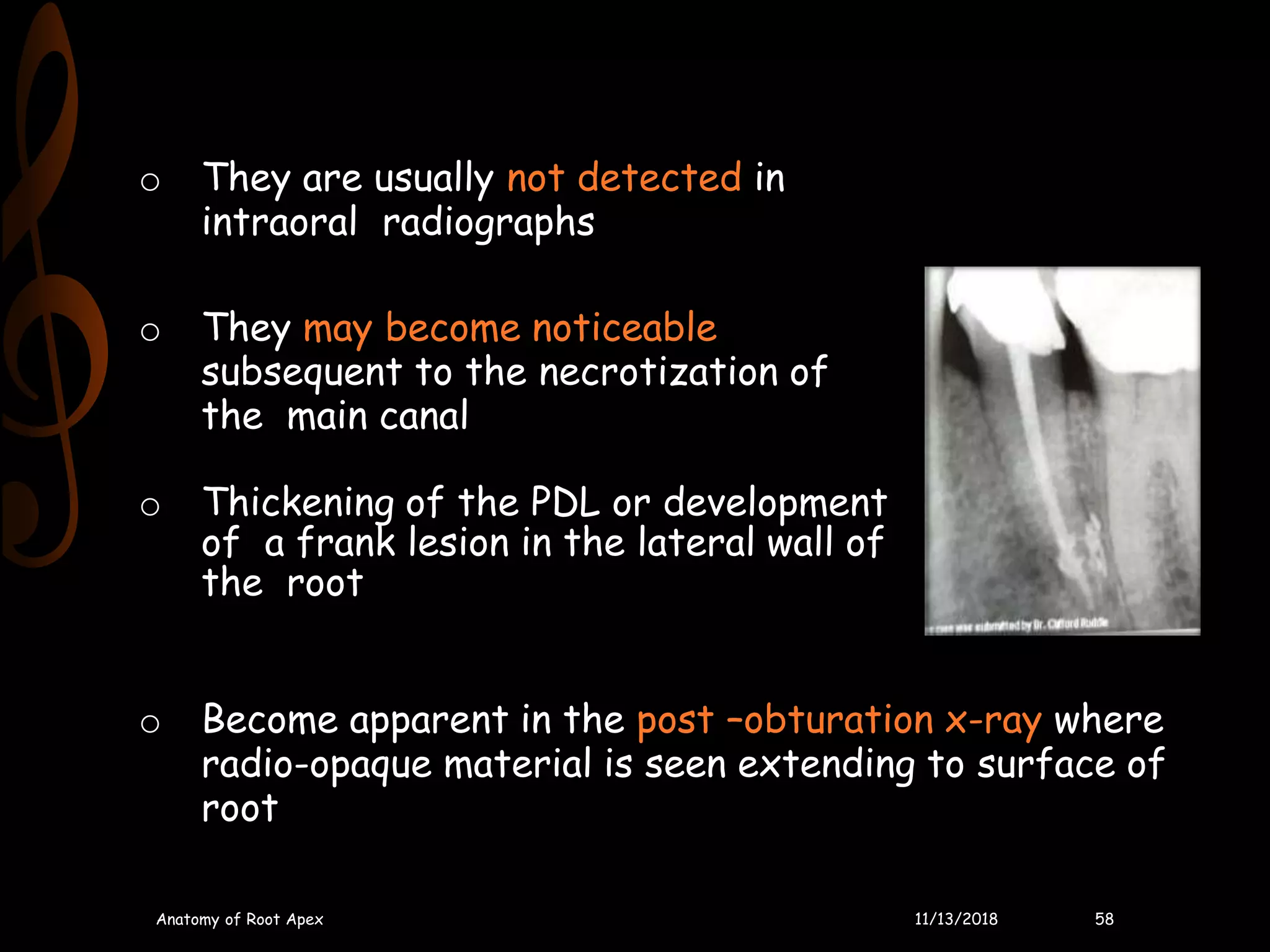 Anatomy of root apex | PPTX