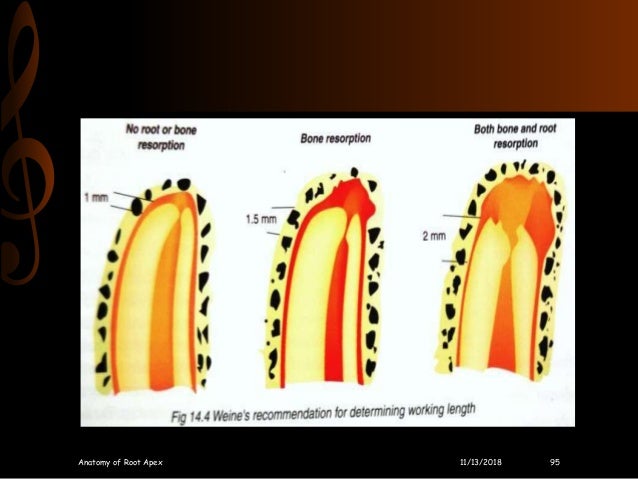 Anatomy Of Root Apex