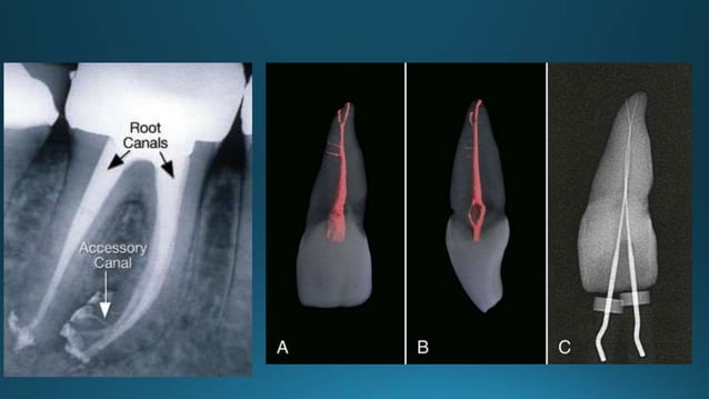 Anatomy of root apex and its significance new | PPTX | Dental Health ...