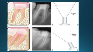 Anatomy of root apex and its significance new | PPTX
