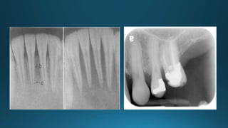Anatomy of root apex and its significance new | PPTX