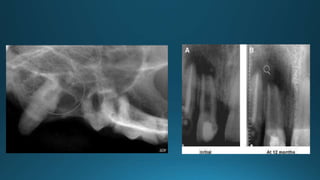 Anatomy of root apex and its significance new | PPTX