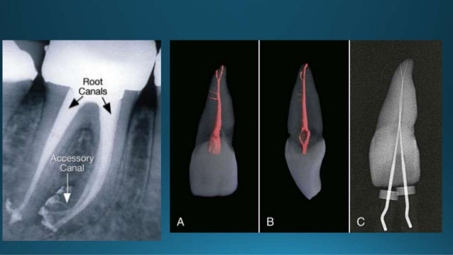 Anatomy of root apex and its significance new