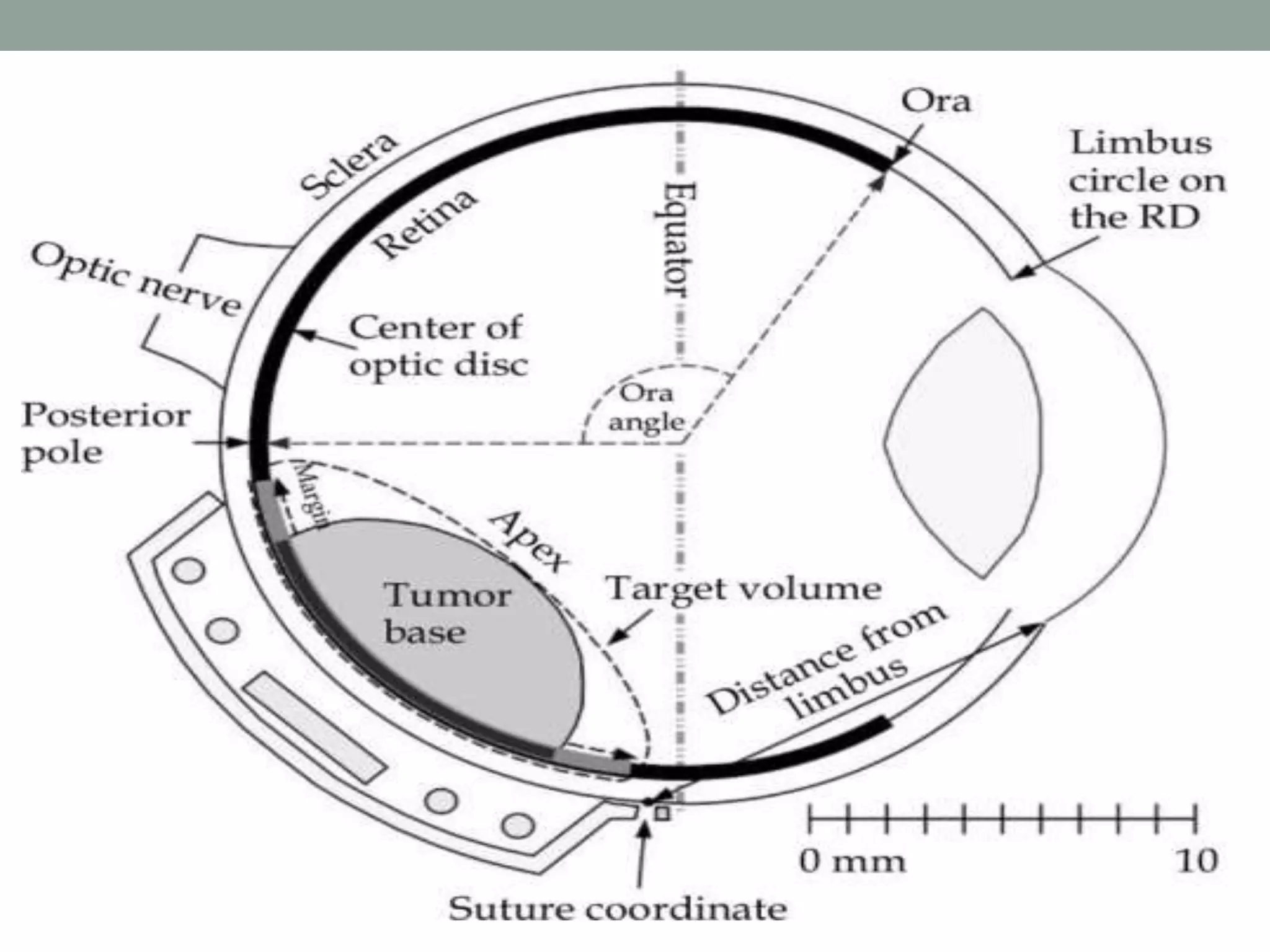 Anatomy of sclera | PPTX