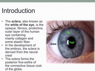 Anatomy of sclera | PPTX | Eye and Vision Conditions | Diseases and ...