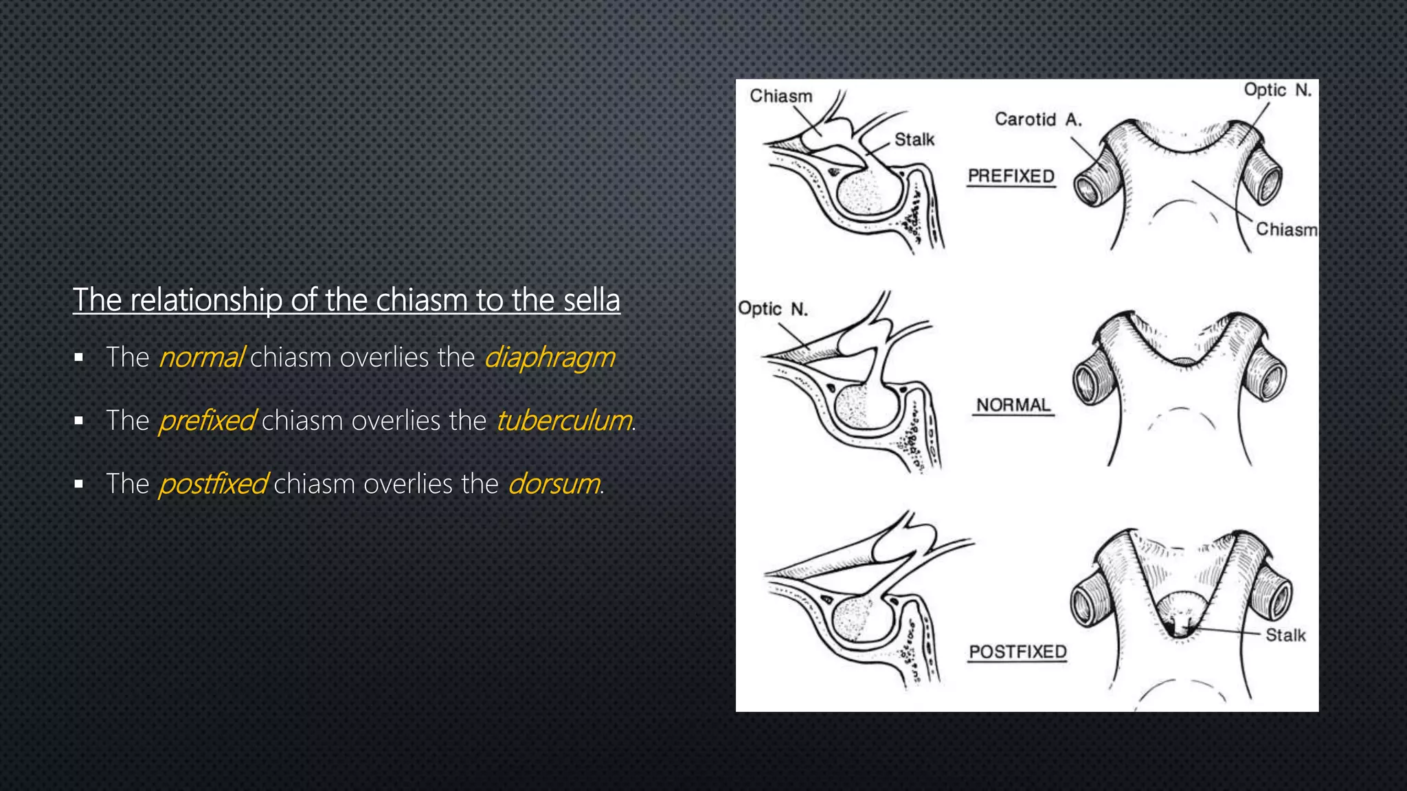 Anatomy of the Sellar Region (A.GH) | PPTX