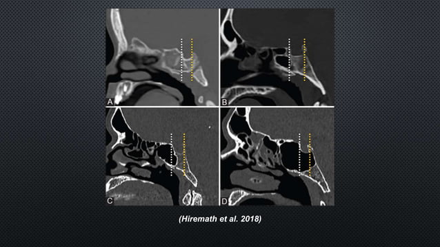 Anatomy of the Sellar Region (A.GH) | PPTX
