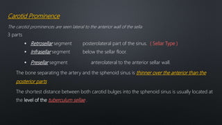 Anatomy of the Sellar Region (A.GH) | PPTX