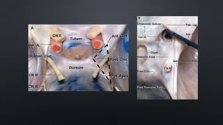 Anatomy of the Sellar Region (A.GH) | PPT