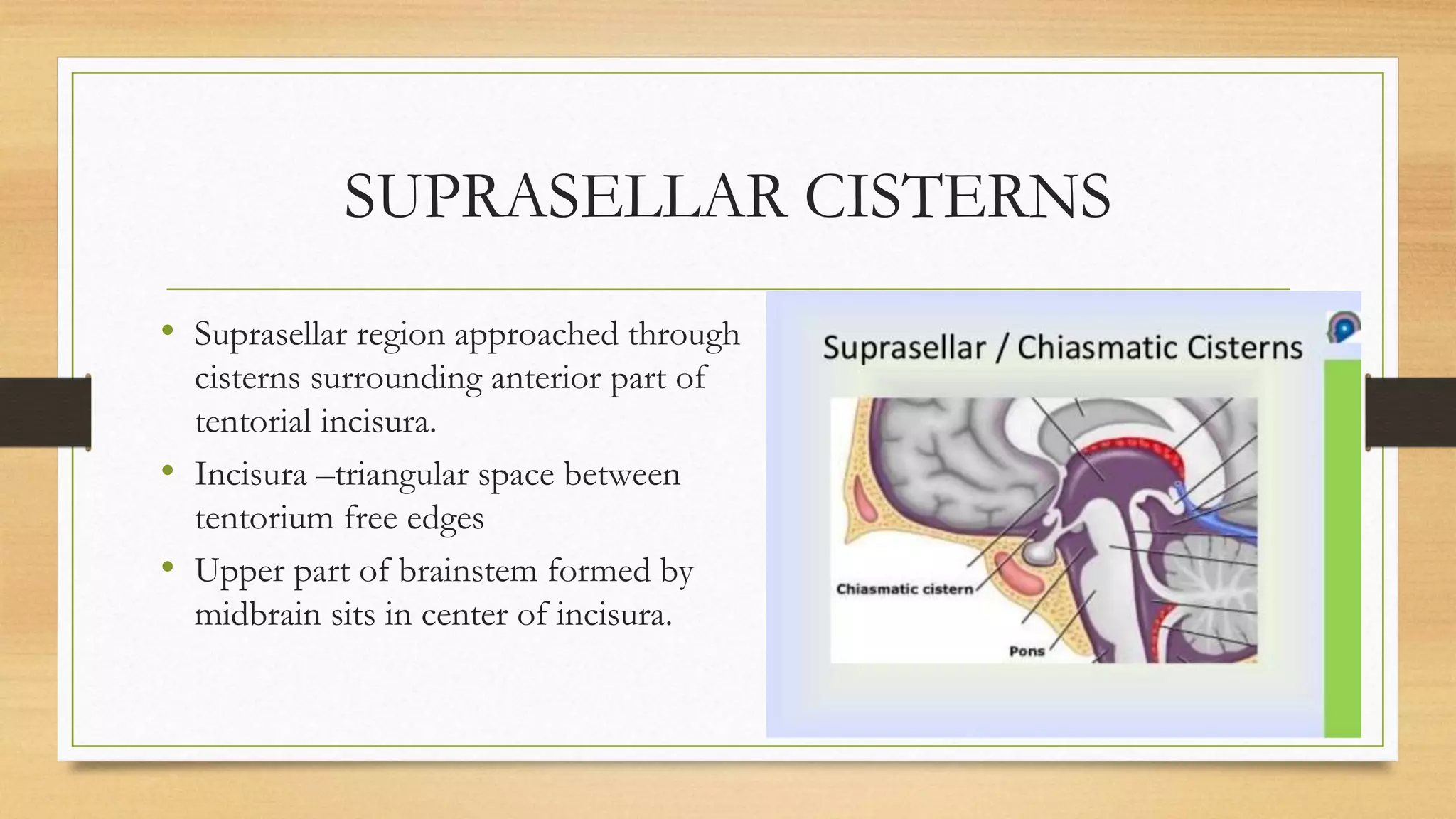 Anatomy of sellar suprasellar region | PPTX