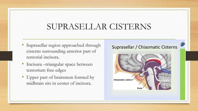 Anatomy of sellar suprasellar region | PPTX