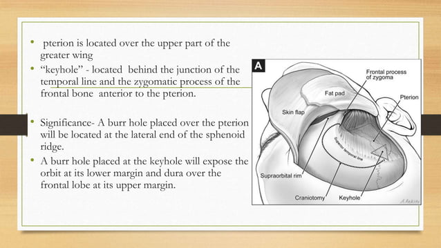 Anatomy of sellar suprasellar region