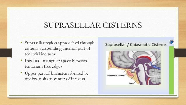 Anatomy of sellar suprasellar region