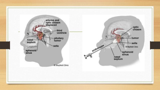 Anatomy of sellar suprasellar region