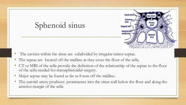 Anatomy of sellar suprasellar region