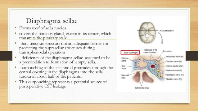 Anatomy of sellar suprasellar region
