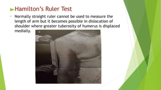 ANATOMY OF SHOULDER JOINT AND ITS EXAMINATION.pptx