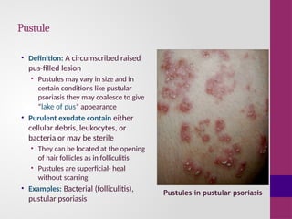 Anatomy of skin and basic skin lesions.pptx