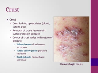 Anatomy of skin and basic skin lesions.pptx