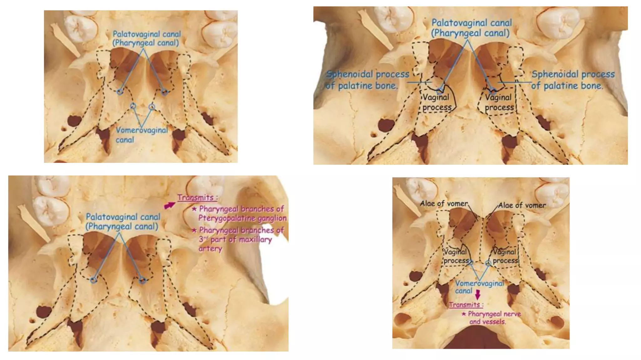 Anatomy of Skul base and Infratempoal fossa | PPT