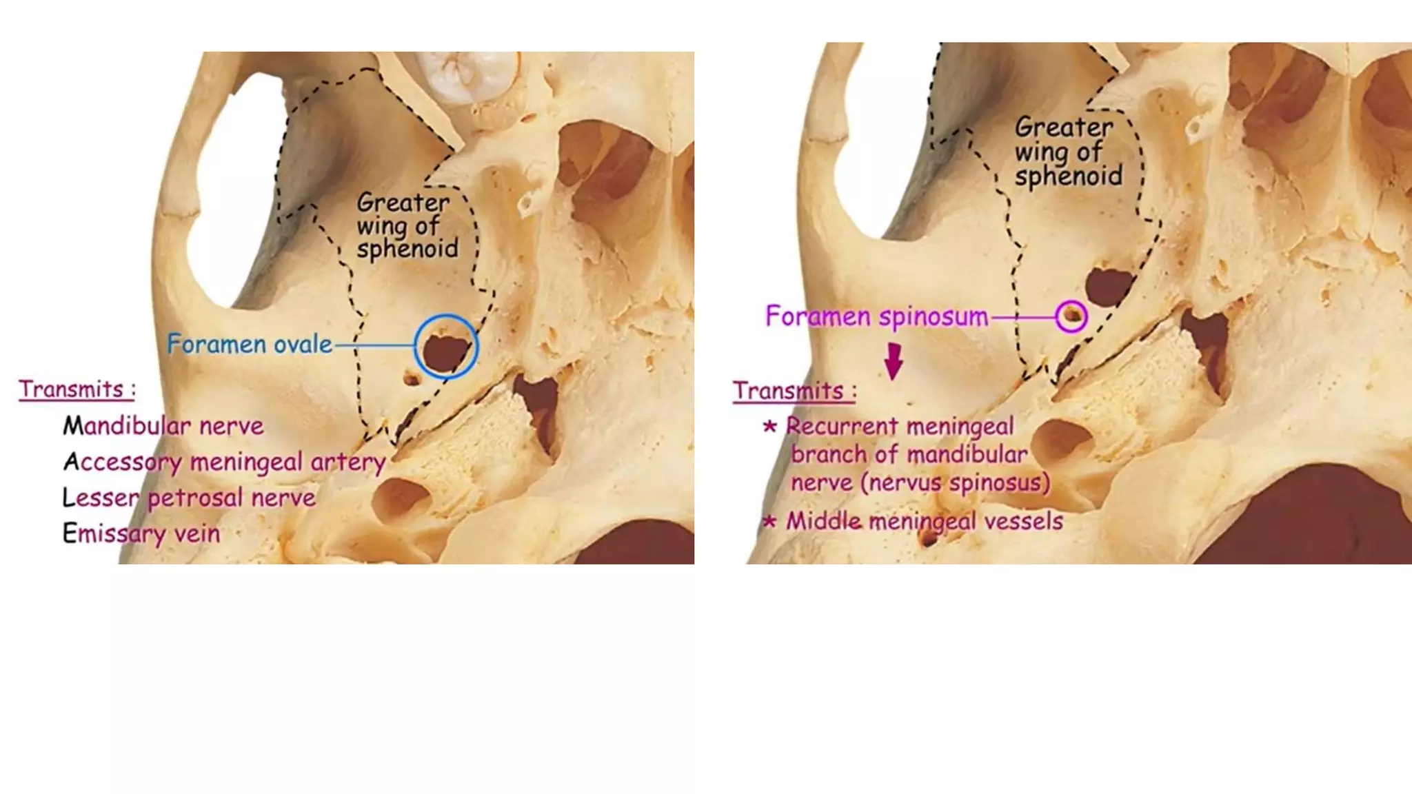 Anatomy of Skul base and Infratempoal fossa | PPT