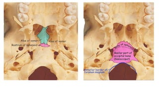 Anatomy of Skul base and Infratempoal fossa | PPT