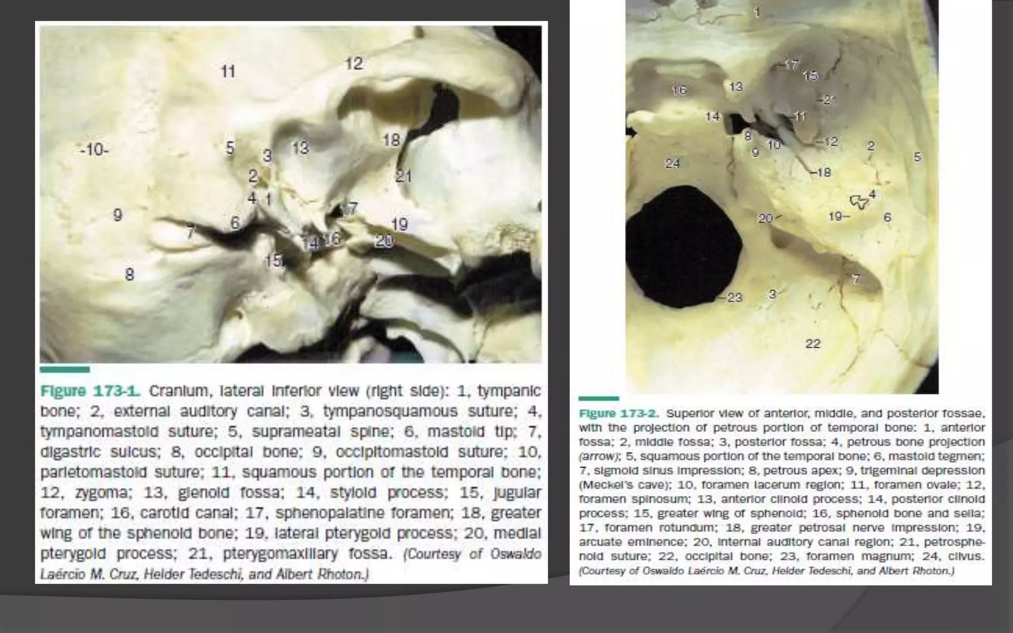 Anatomy of skull base | PPTX