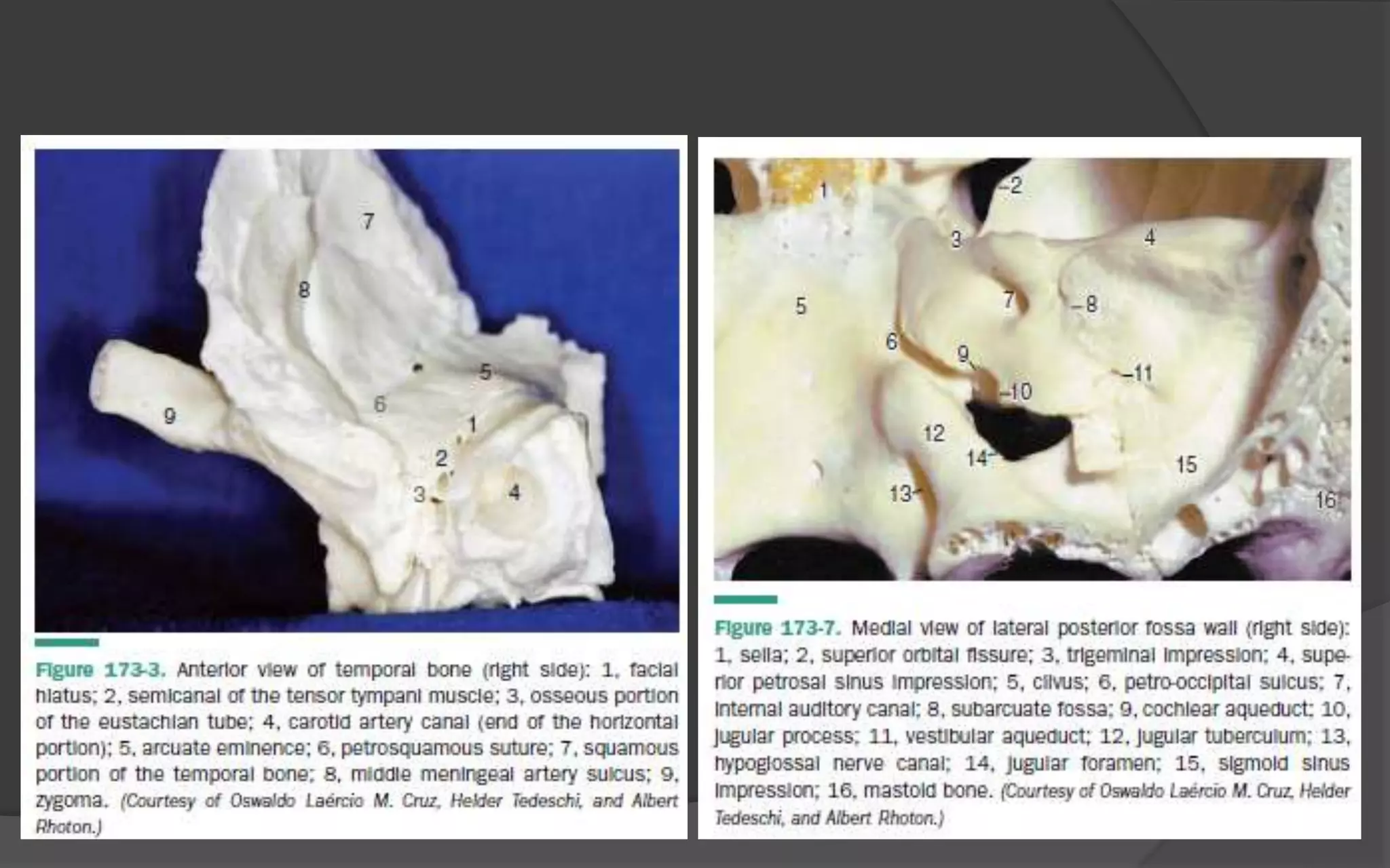 Anatomy of skull base | PPTX
