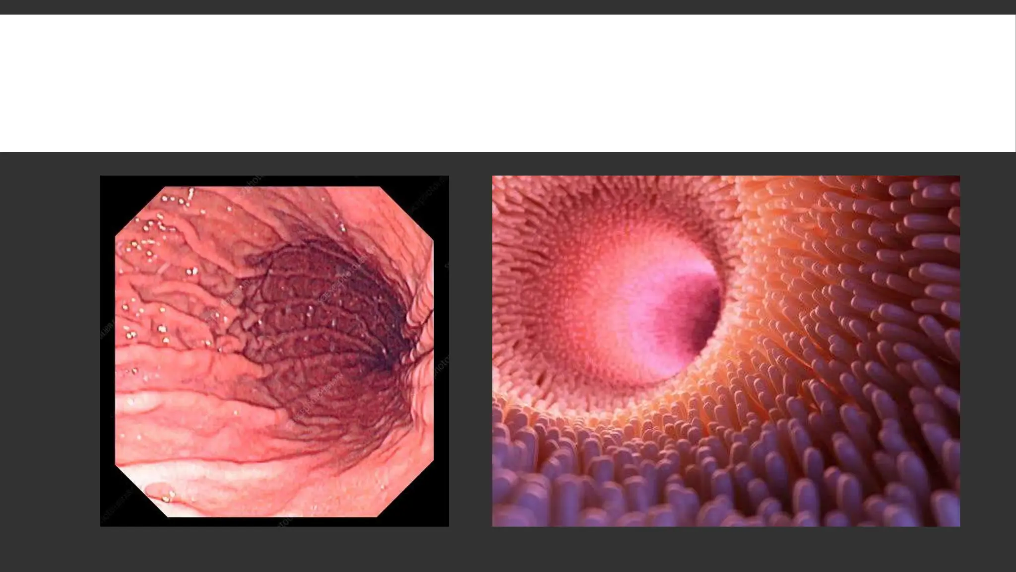 ANATOMY OF SMALL INTESTINE -presentation | PPTX
