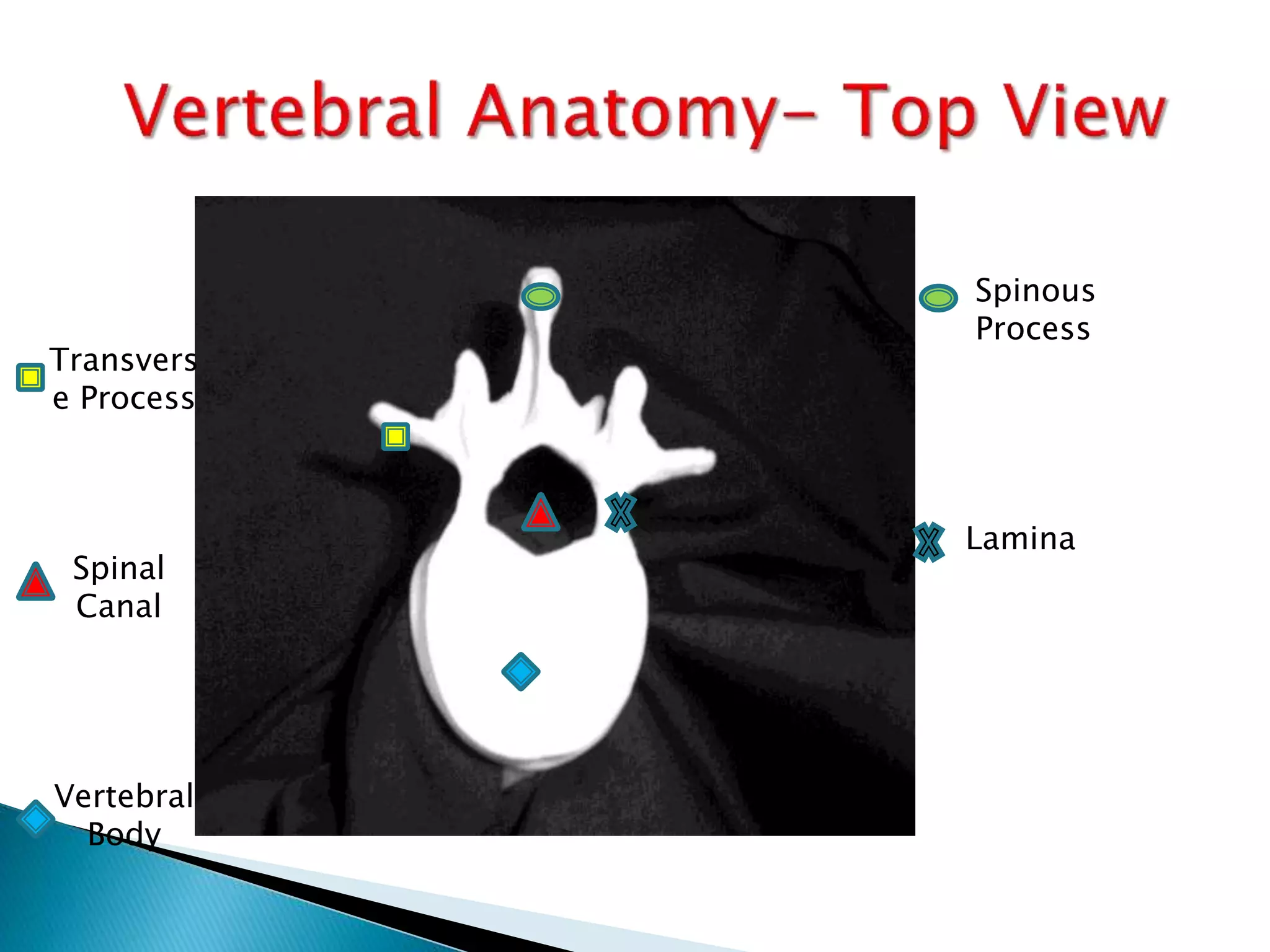 Anatomy of spine for spinal anaesthesia | PPTX