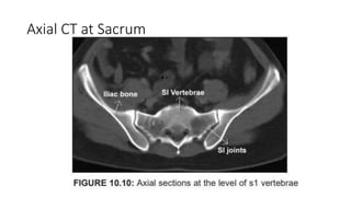 Anatomy of Spine pptx | PPTX
