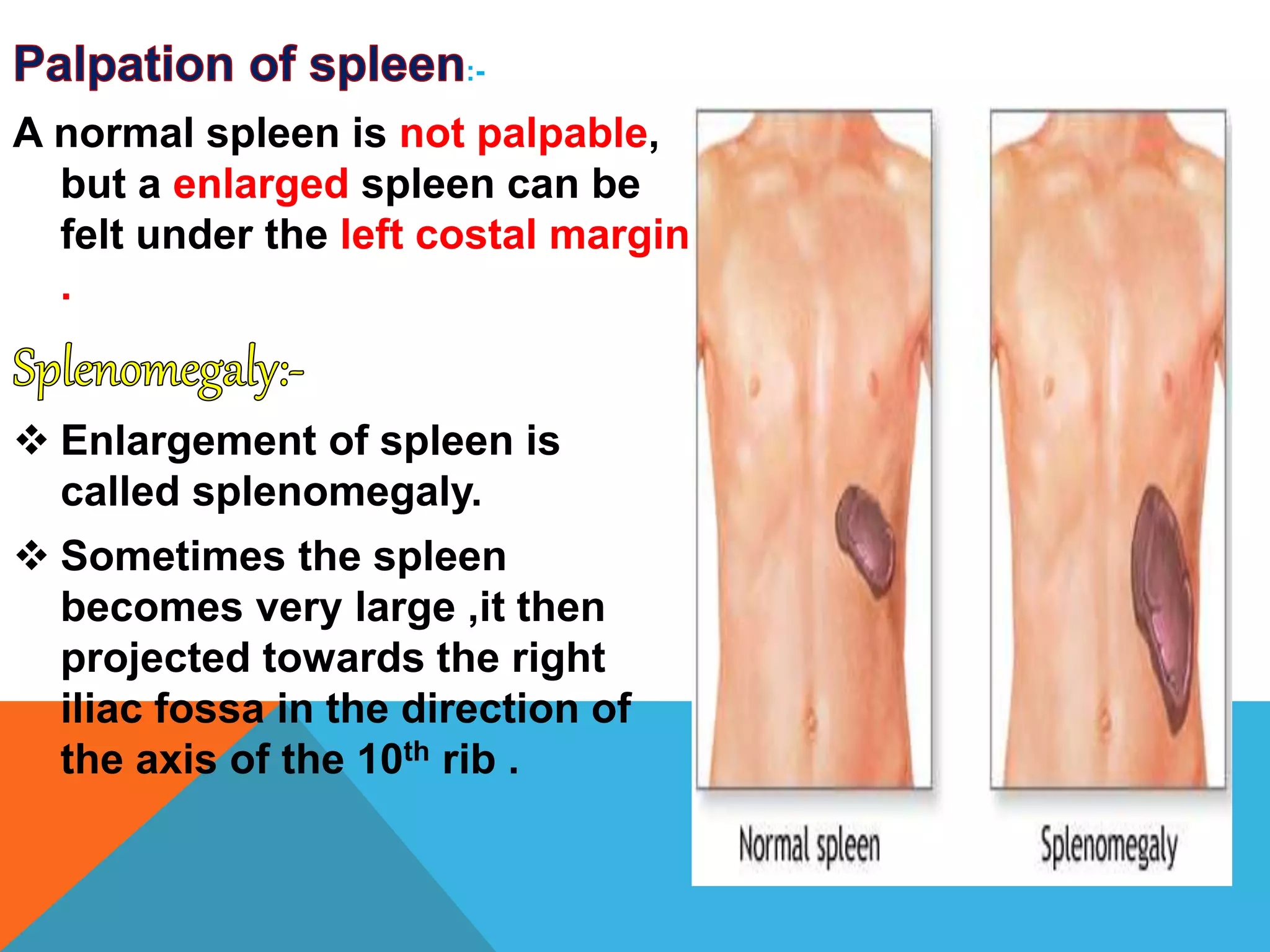 Anatomy of spleen | PPTX | Digestive Disorders | Diseases and Conditions