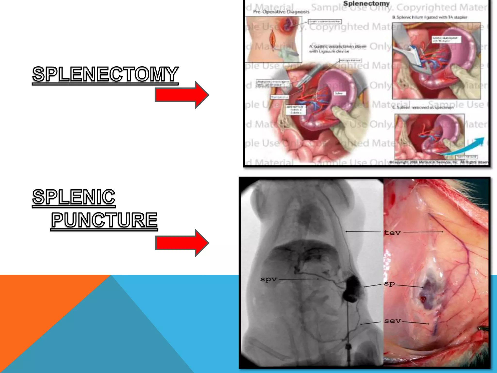 Anatomy of spleen | PPTX | Digestive Disorders | Diseases and Conditions