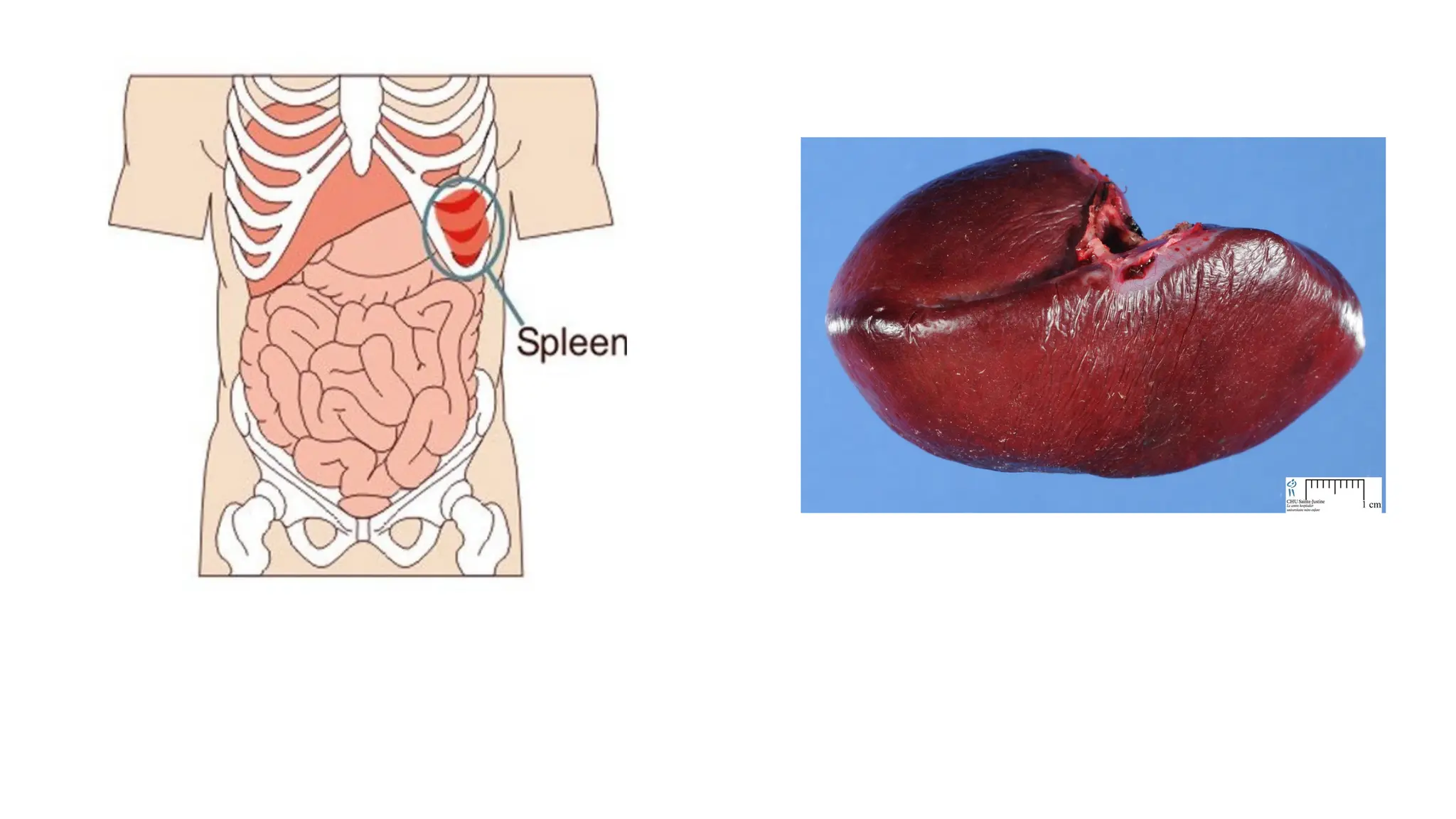 ANATOMY OF SPLEEN.pptx #Anatomy 1st year | PPTX