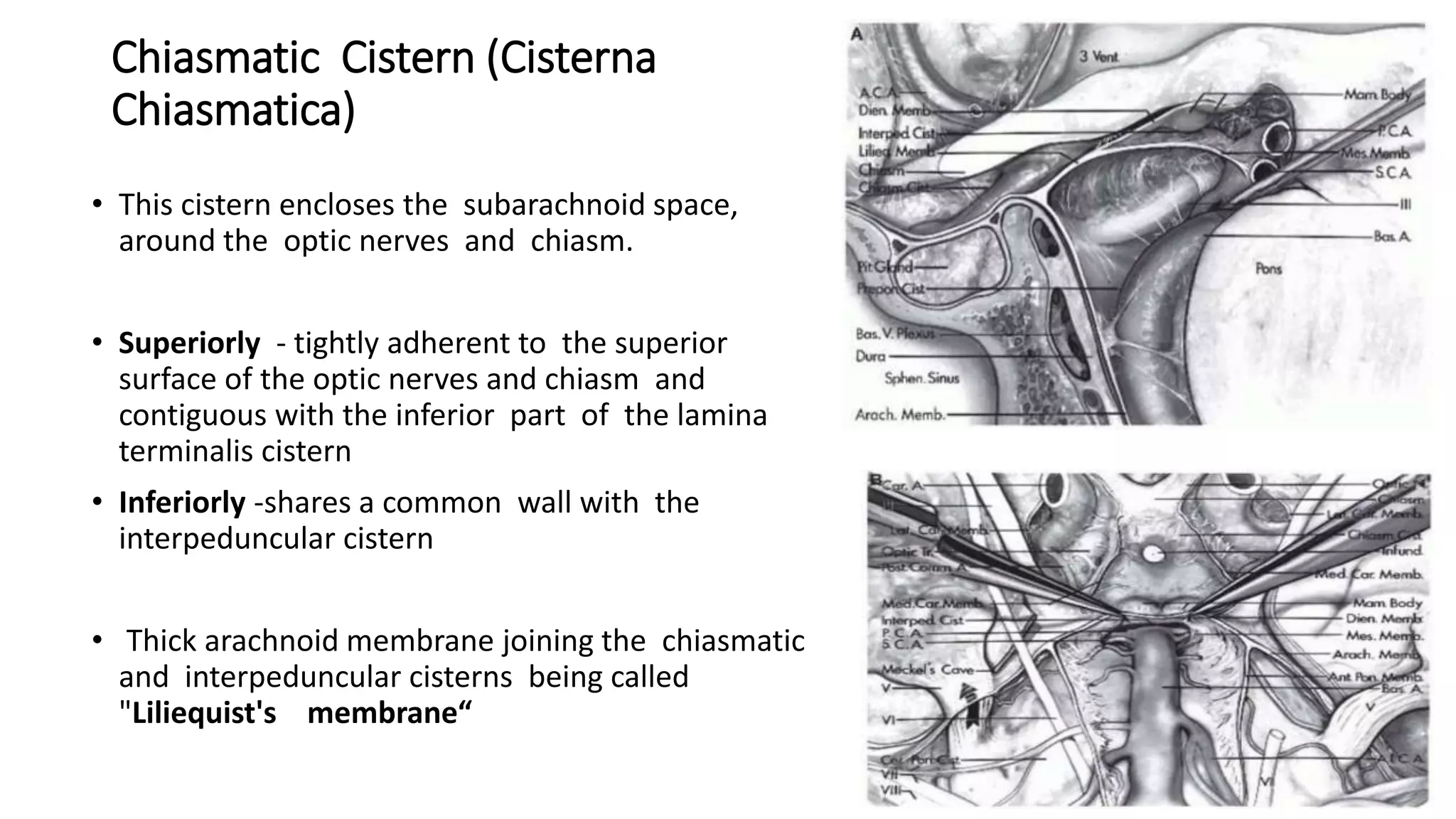 ANATOMY OF SUBARACHNOID CISTERNS OF BRAIN | PPTX